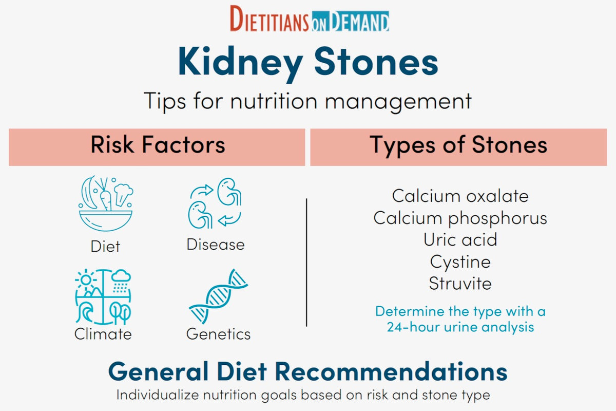 Kidney Stones: Tips for Nutrition Management | Infographic – Dietitians ...