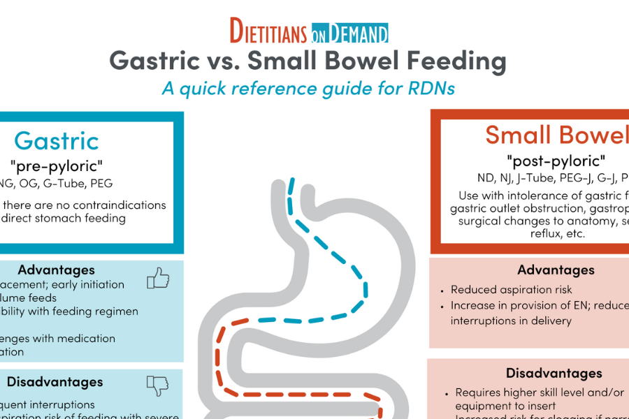 Gastric vs Small Bowel Feeding | Infographic – Dietitians On Demand