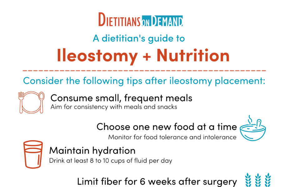 A Dietitian's Guide to Ileostomy Nutrition | Infographic – Dietitians ...